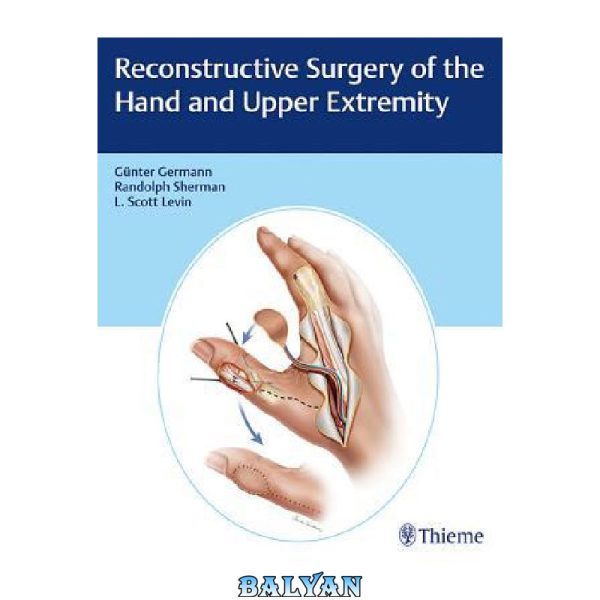 دانلود کتاب Reconstructive Surgery of the Hand and Upper Extremity - بلیان