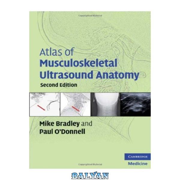 دانلود کتاب Atlas of Musculoskeletal Ultrasound Anatomy - بلیان