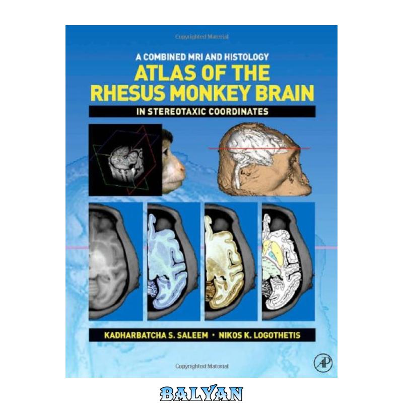 دانلود کتاب A Combined MRI and Histology Atlas of the Rhesus Monkey ...